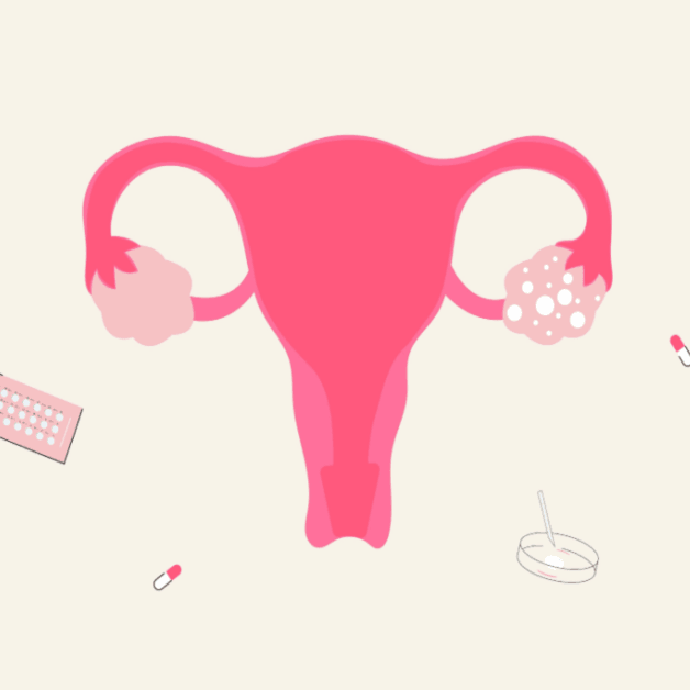 Understanding PCOS and How It Affects Women's Bodies - BFM Podcast ...